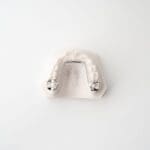 Rake Appliance | ODL Orthodontic Labs