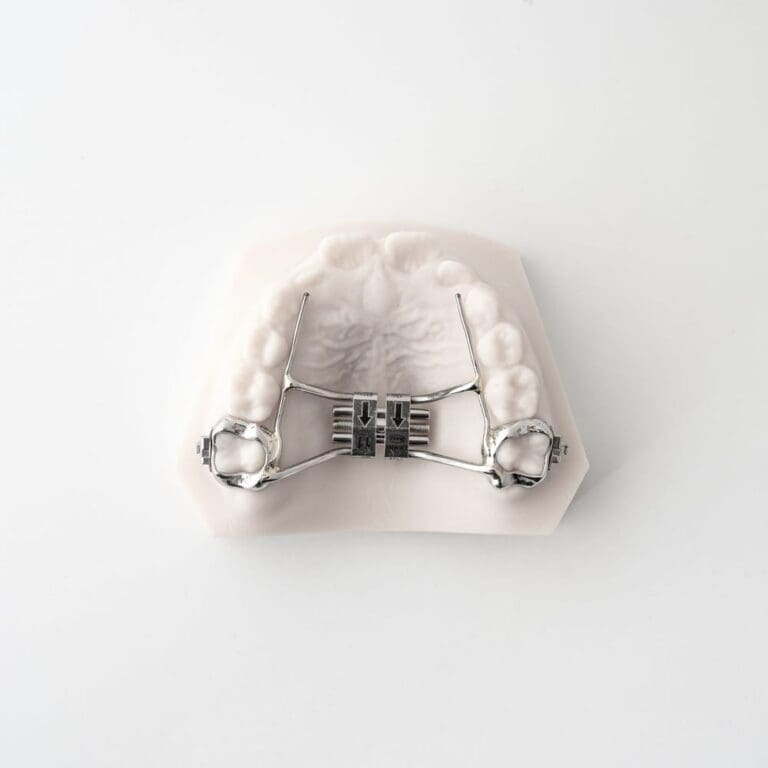 Rapid Palatal Expander | ODL Orthodontic Labs