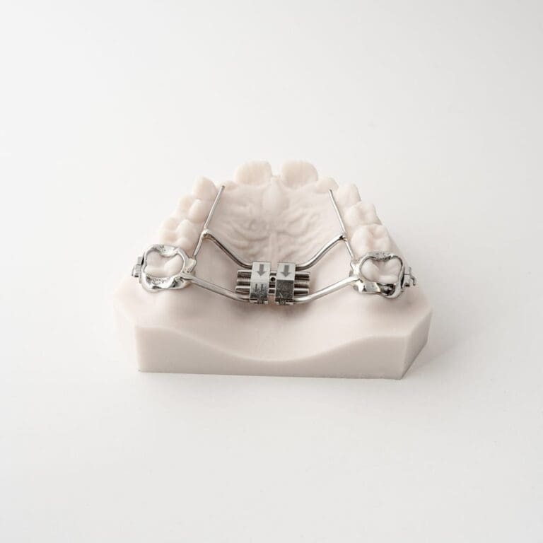 Rapid Palatal Expander | ODL Orthodontic Labs