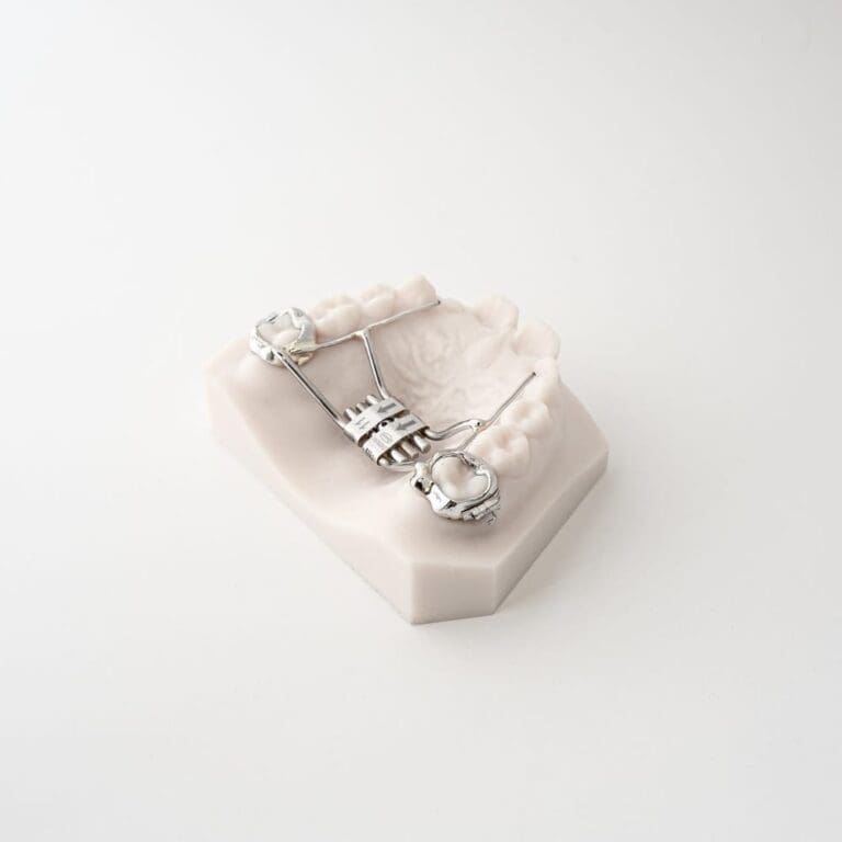 Rapid Palatal Expander | ODL Orthodontic Labs