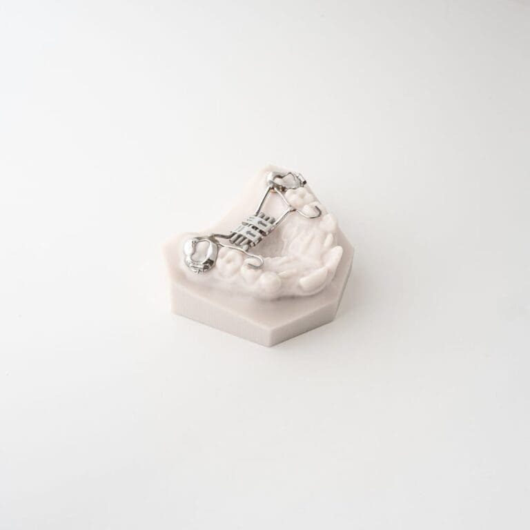 Rapid Palatal Expander | ODL Orthodontic Labs