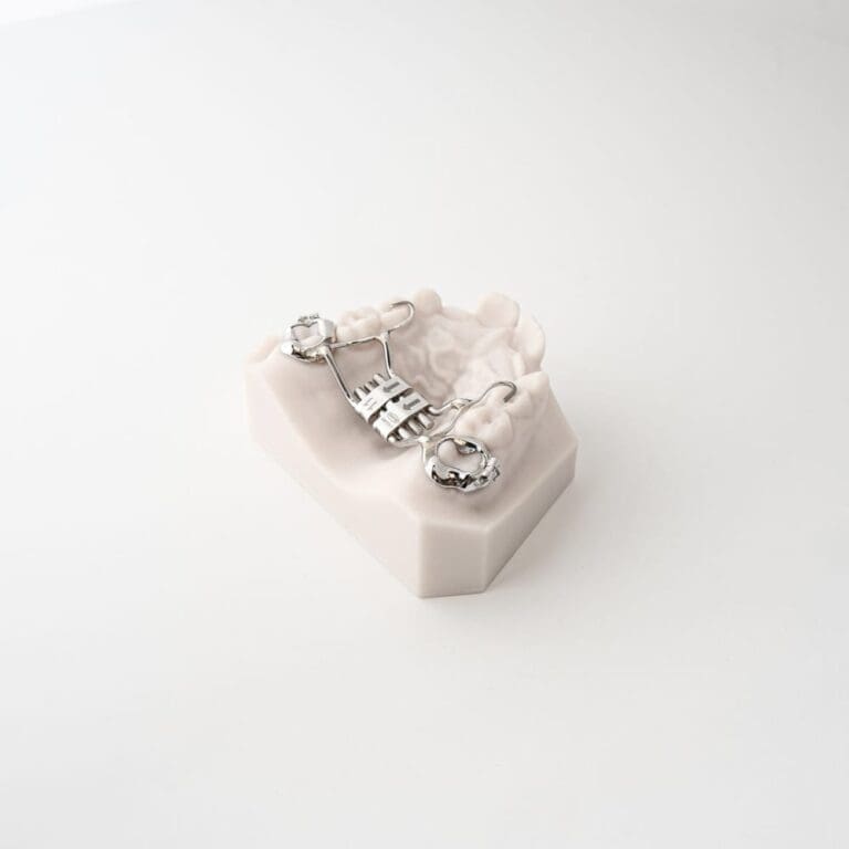 Rapid Palatal Expander | ODL Orthodontic Labs