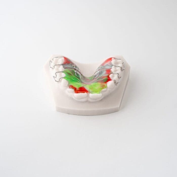 Digital Anterior Repositioning Splint | ODL Orthodontic Labs