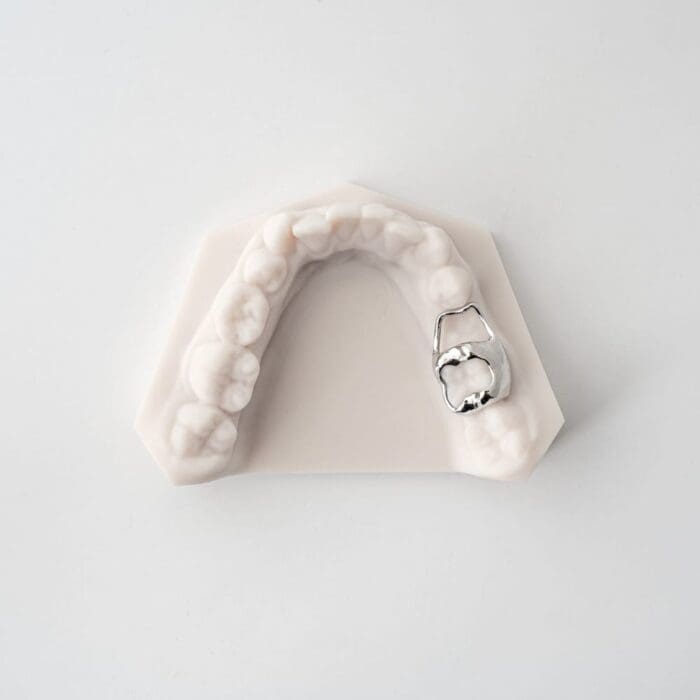 Space Maintainer | ODL Orthodontic Labs