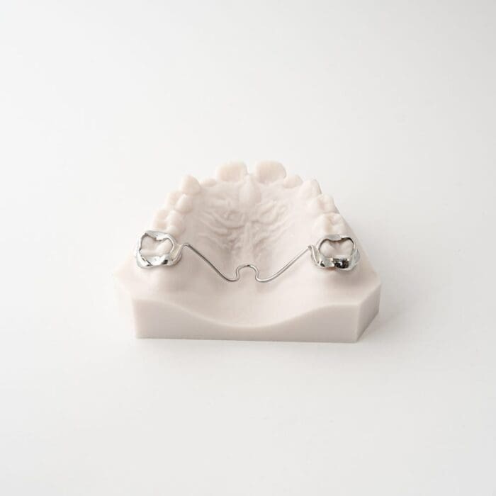 TPA (Transpalatal Arch) | ODL Orthodontic Labs