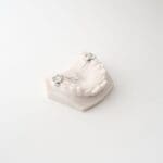 TPA (Transpalatal Arch) | ODL Orthodontic Labs