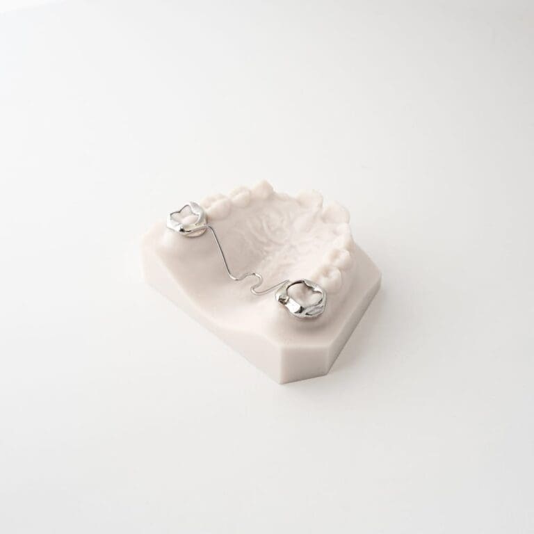 TPA (Transpalatal Arch) | ODL Orthodontic Labs