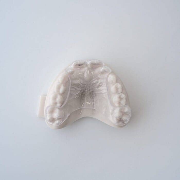 Theroux Phase 1 Retainer | ODL Orthodontic Labs