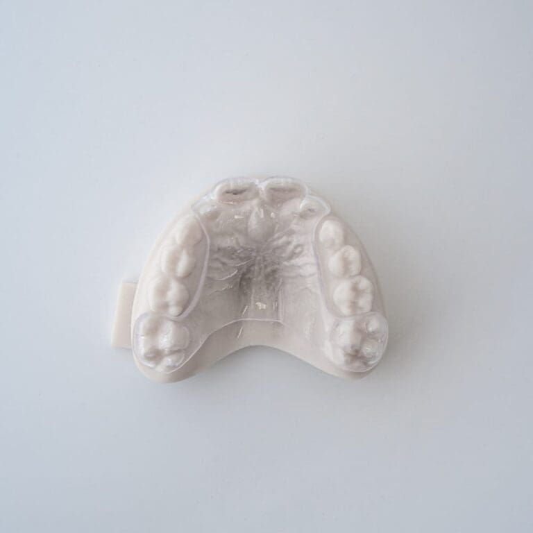 Theroux Phase 1 Retainer | ODL Orthodontic Labs