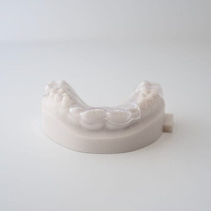 Theroux Phase 1 Retainer | ODL Orthodontic Labs