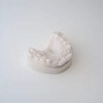 Theroux Phase 1 Retainer | ODL Orthodontic Labs