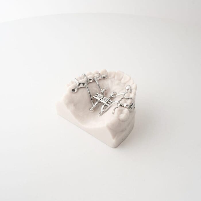 Tomas Tad Expander | ODL Orthodontic Labs