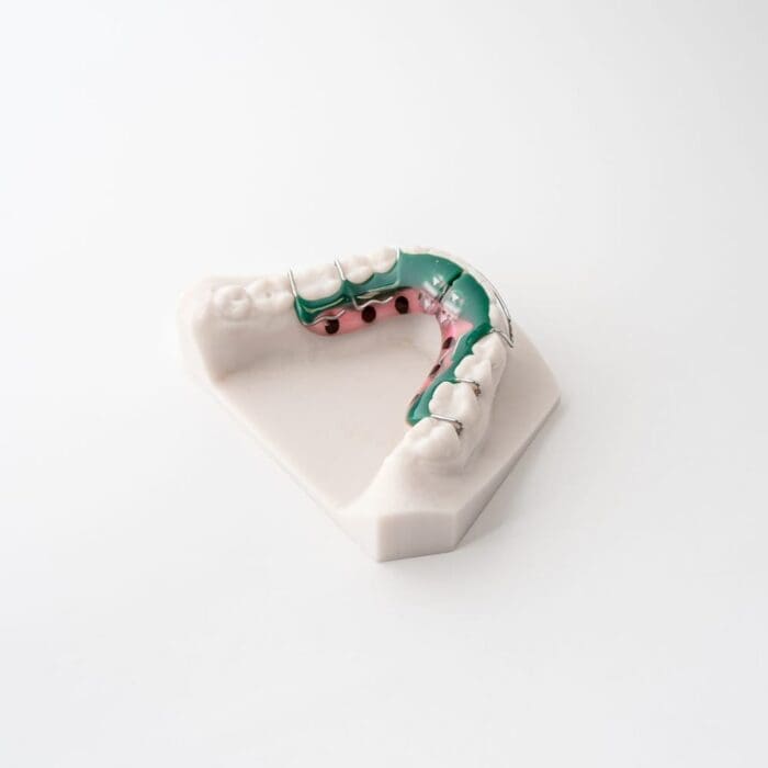 Transverse Appliance (Schwartz Appliance) | ODL Orthodontic Labs
