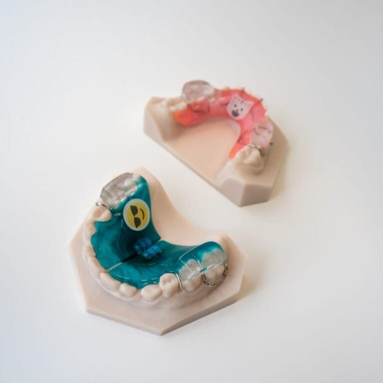 Theroux Phase 1 Retainer | ODL Orthodontic Labs