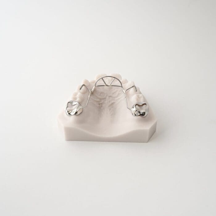 Vertical Tongue Crib | ODL Orthodontic Labs