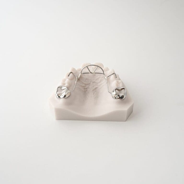 Vertical Tongue Crib | ODL Orthodontic Labs