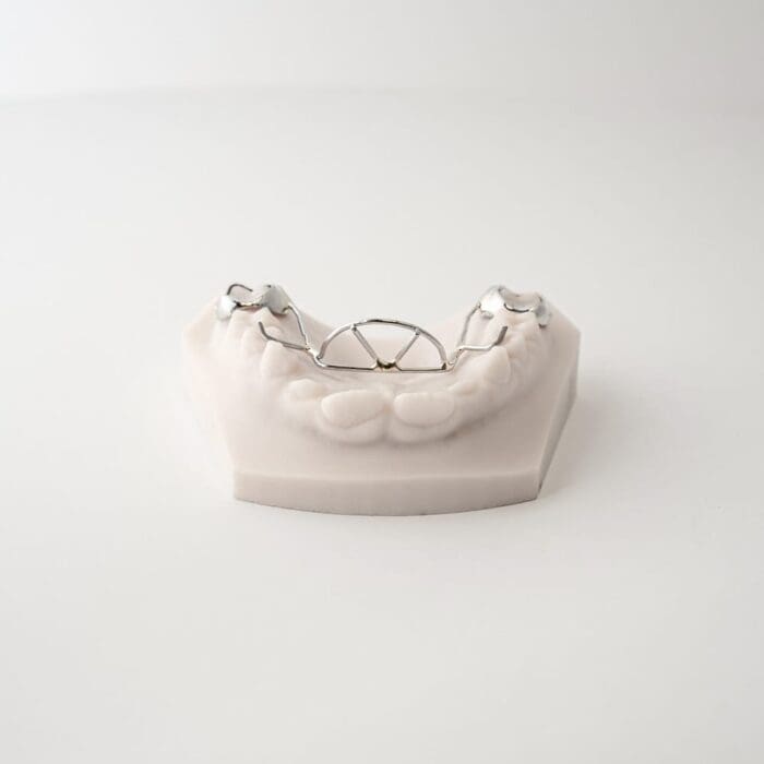 Vertical Tongue Crib | ODL Orthodontic Labs