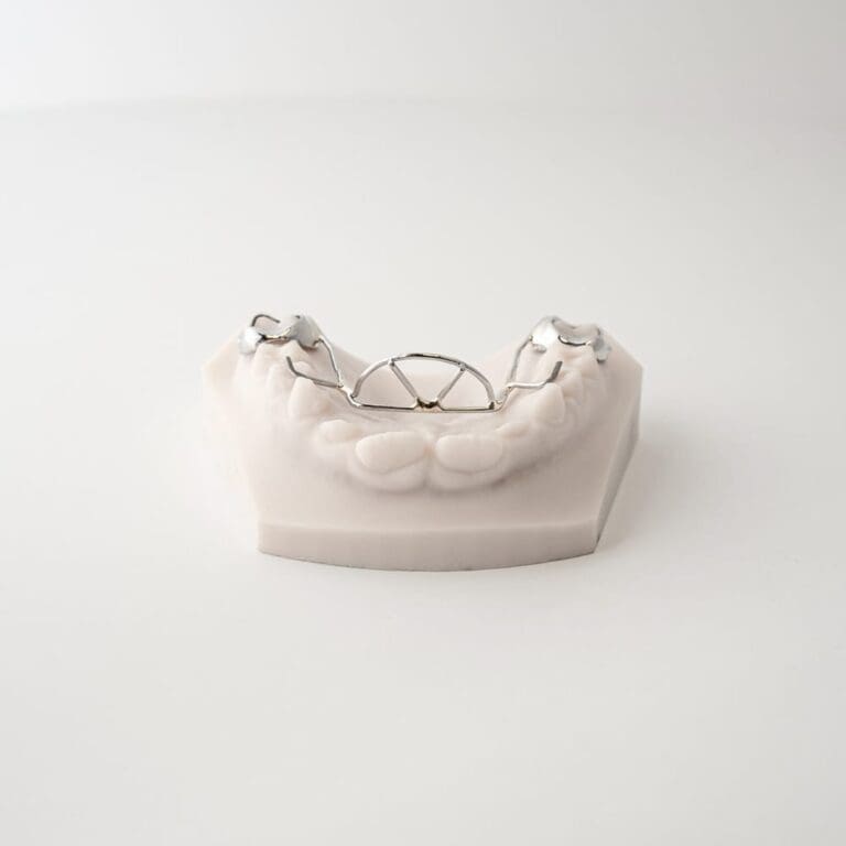 Vertical Tongue Crib | ODL Orthodontic Labs