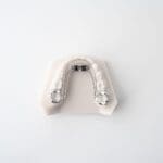 Williams Expander | ODL Orthodontic Labs