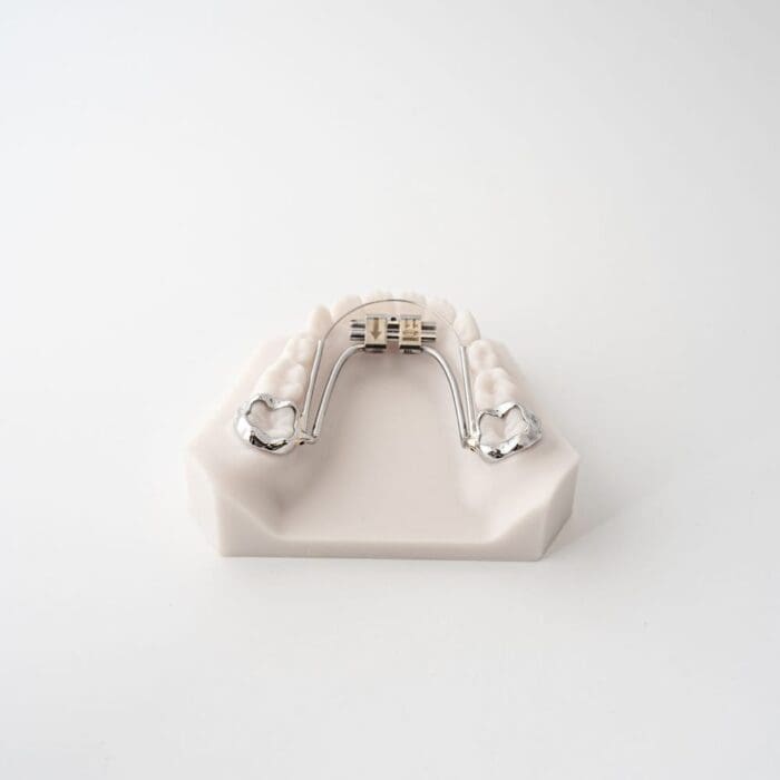Williams Expander | ODL Orthodontic Labs