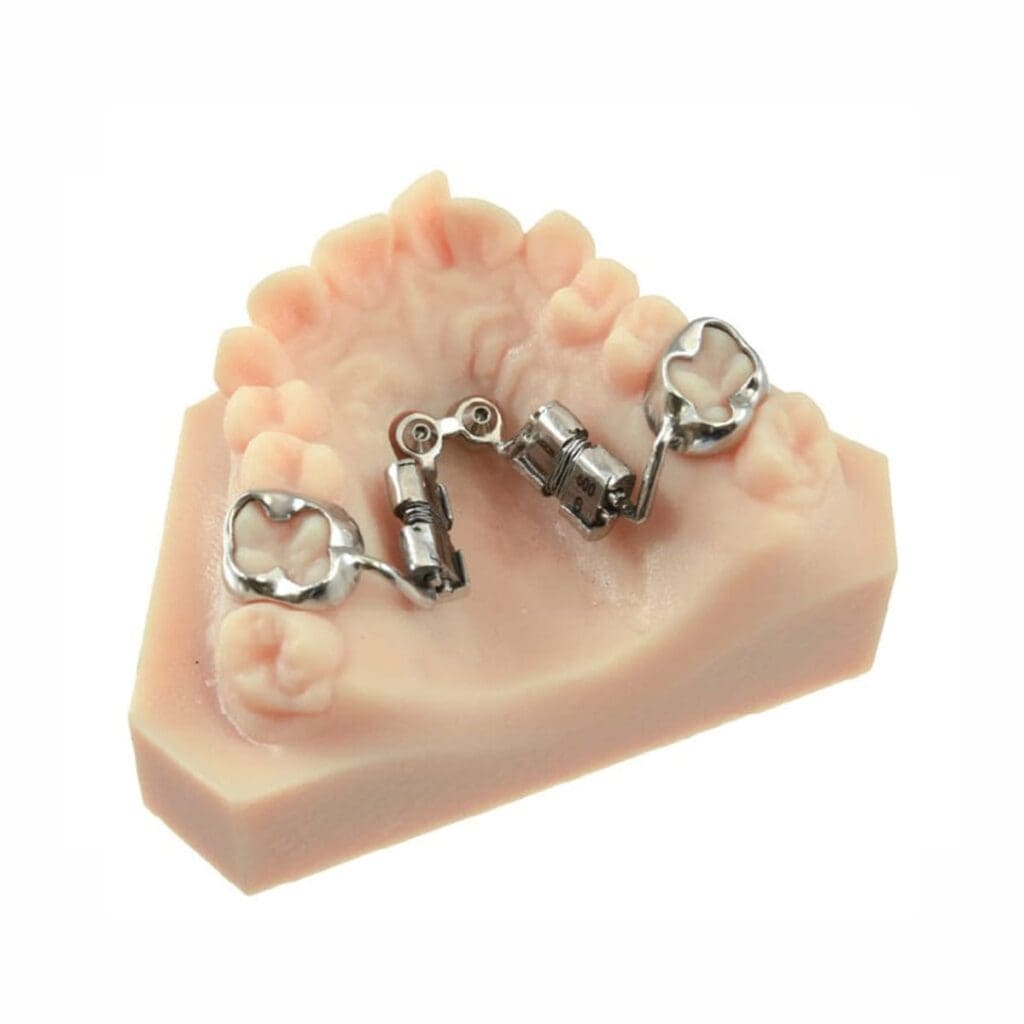 HAAS Expander | ODL Orthodontic Labs