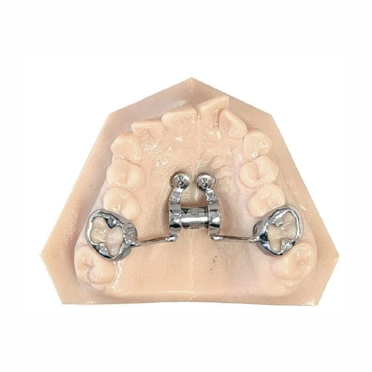 HAAS Expander | ODL Orthodontic Labs