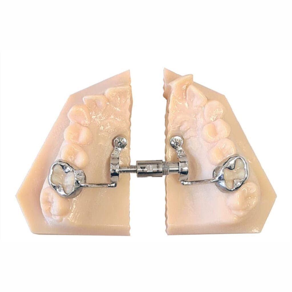 HAAS Expander | ODL Orthodontic Labs