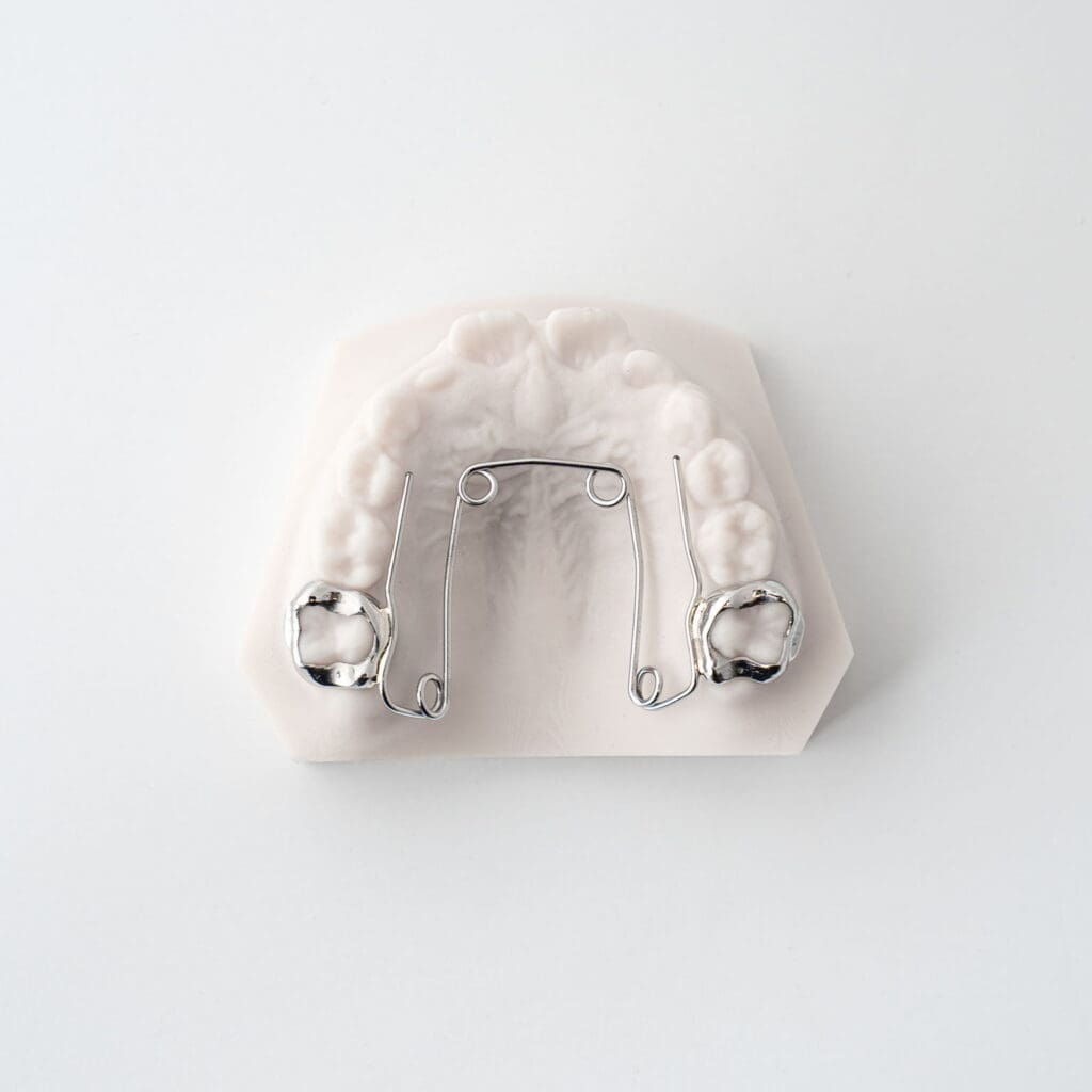 Quad Helix | ODL Orthodontic Labs