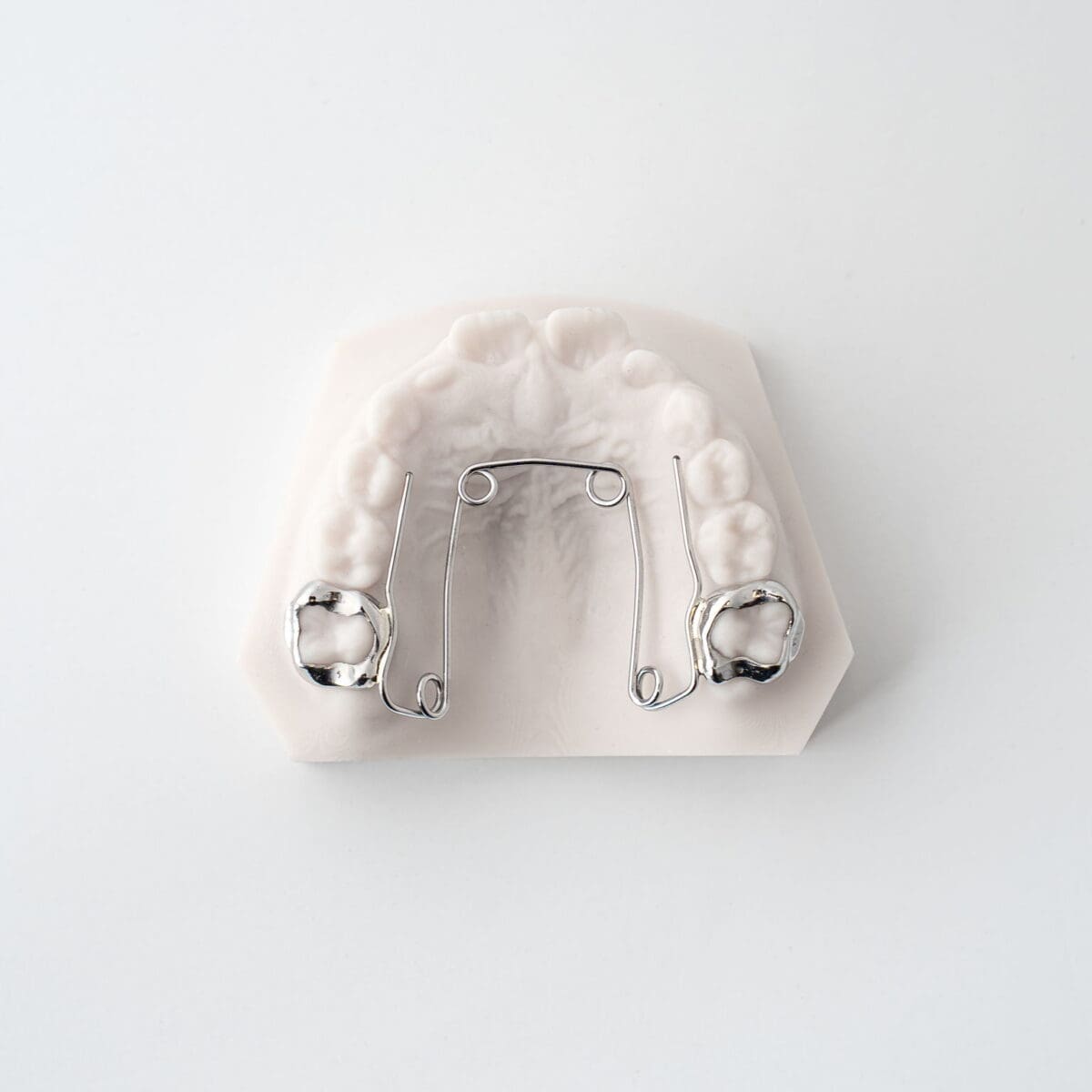 Quad Helix | ODL Orthodontic Labs