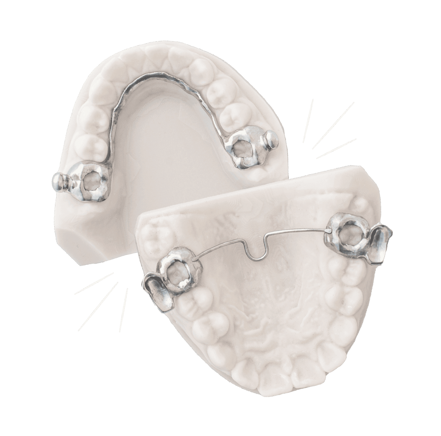 Casper | The Next Generation of Class II Correction | ODL