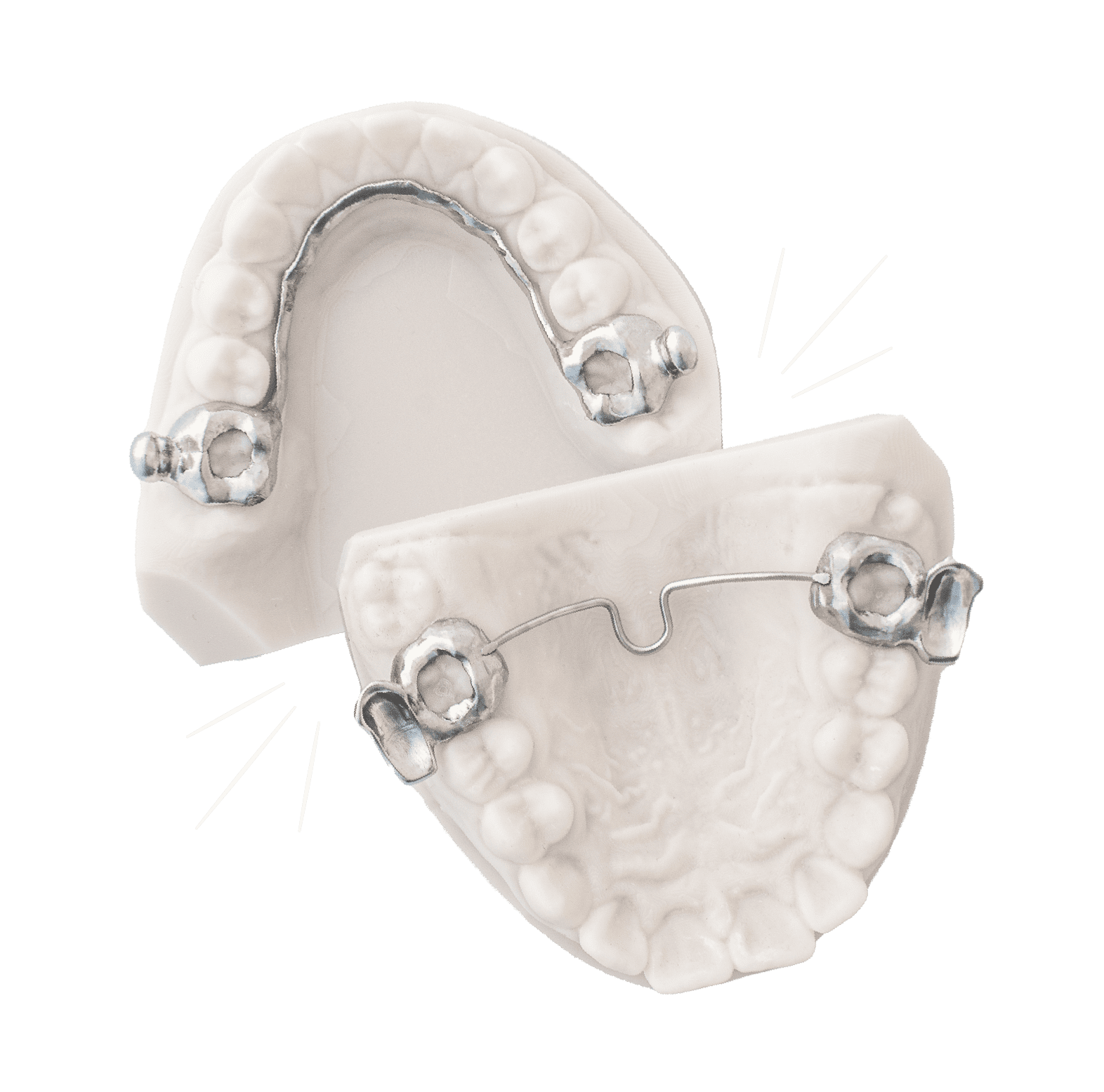 Casper | The Next Generation of Class II Correction | ODL